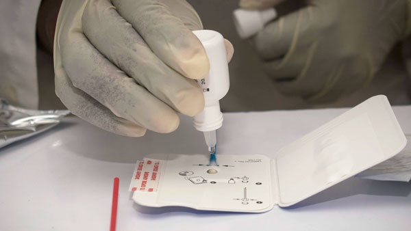 World Health Organization endorses Truenat tests for initial diagnosis ...